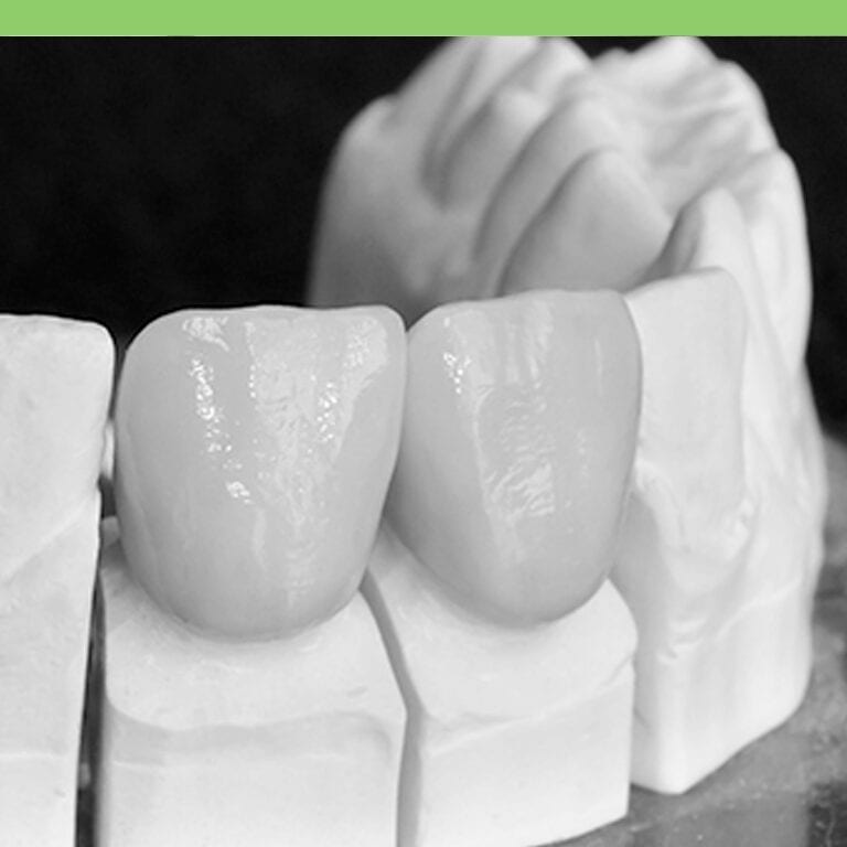 Ceramic Crowns - Costa Rica Dental Guide to Best Dentists
